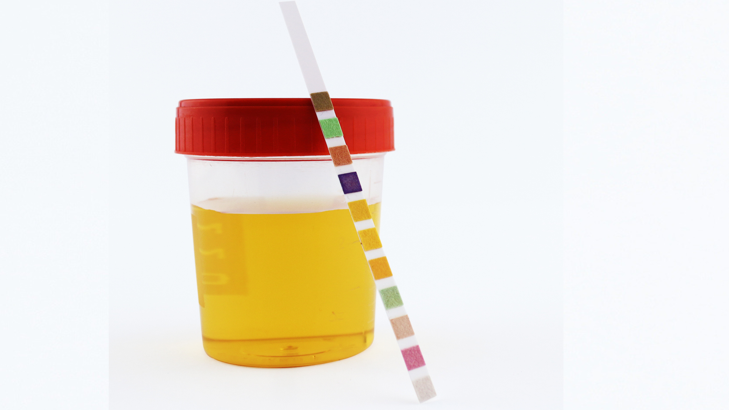 Here's Why Some Runners Are Testing Their Urine pH